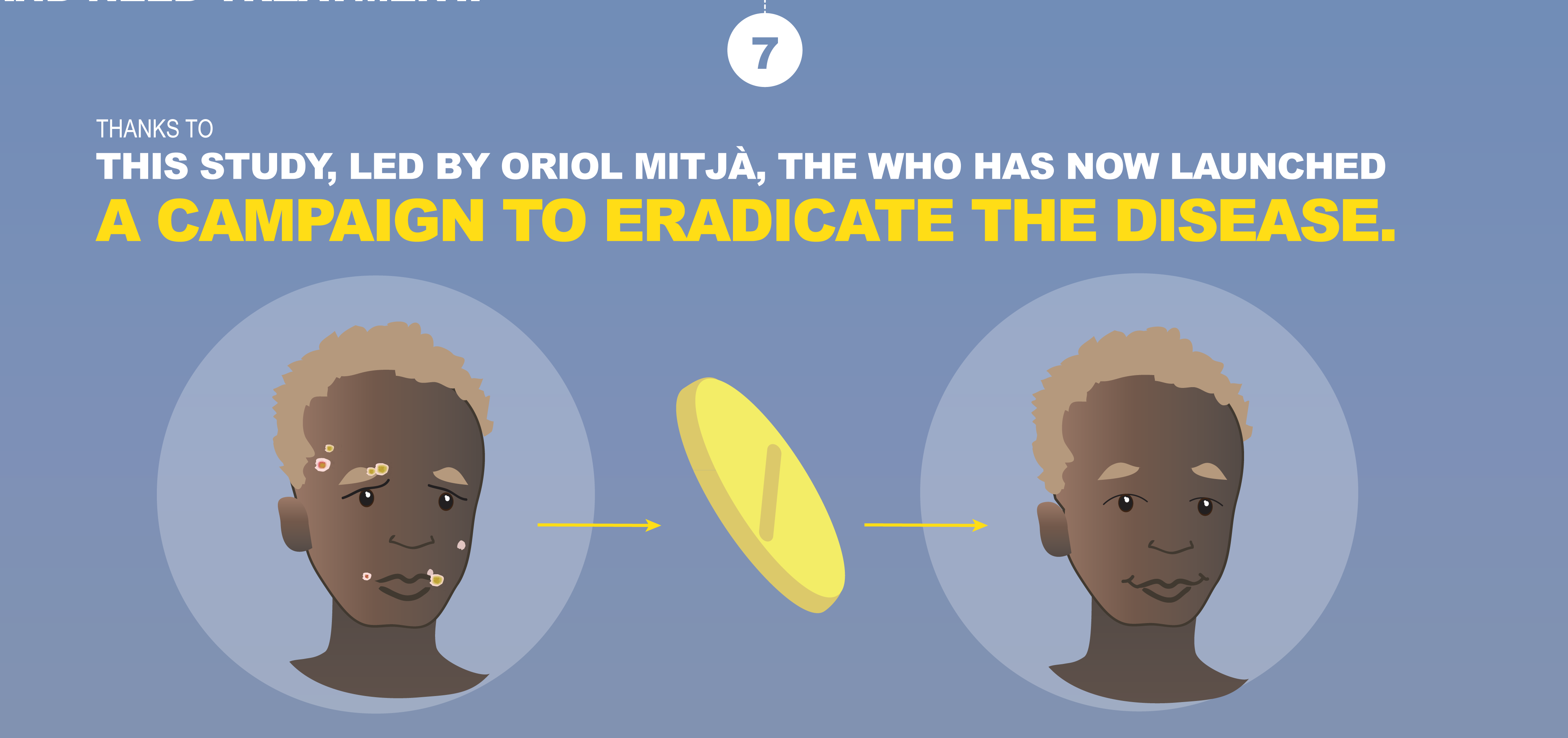 7 things we should remember after yaws has been eradicated - Multimedia ...