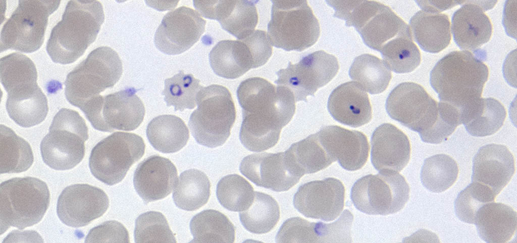 Malaria Parasite Population Genetics and Adaptation to Diverse ...